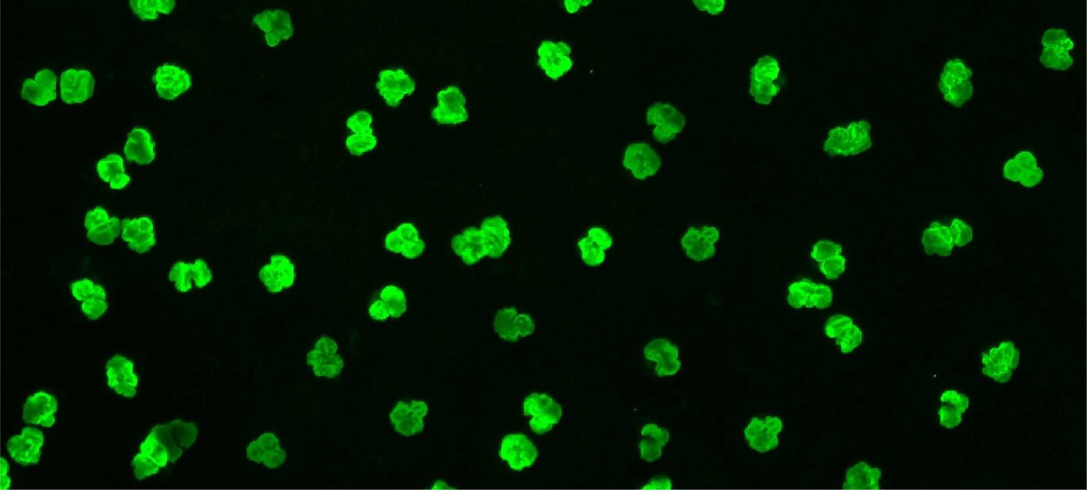 ANCA Ethanol Fluorescent Test System – Immuno Concepts