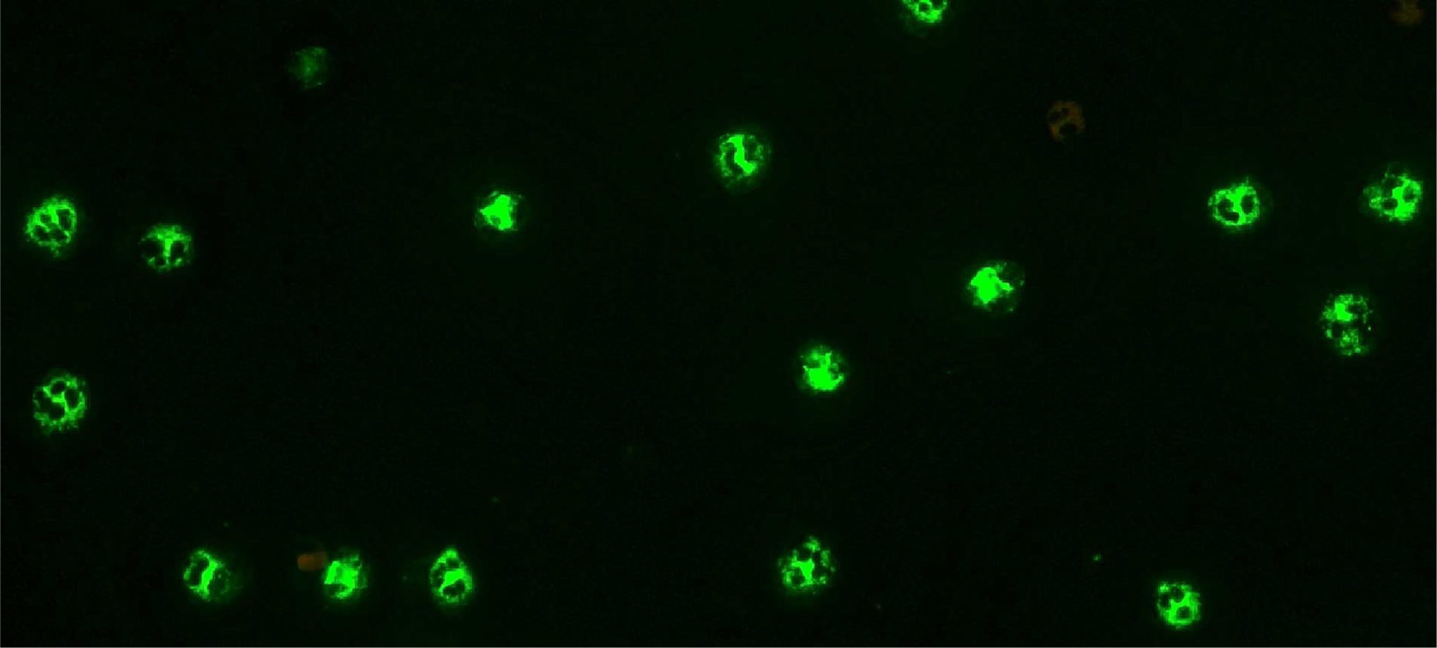 ANCA Formalin Fluorescent Test System – Immuno Concepts