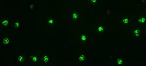 ANCA Formalin Fluorescent Test System – Immuno Concepts