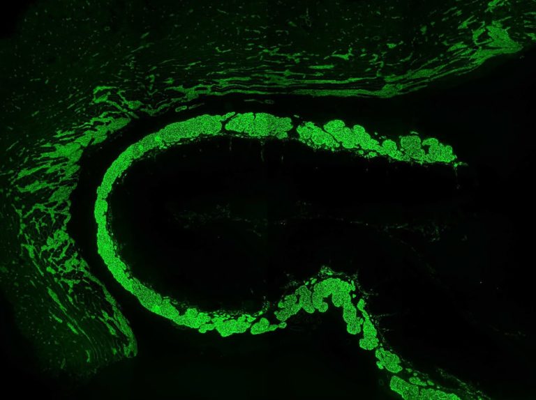 HISTOFLUOR EmA Fluorescent Test System – Immuno Concepts