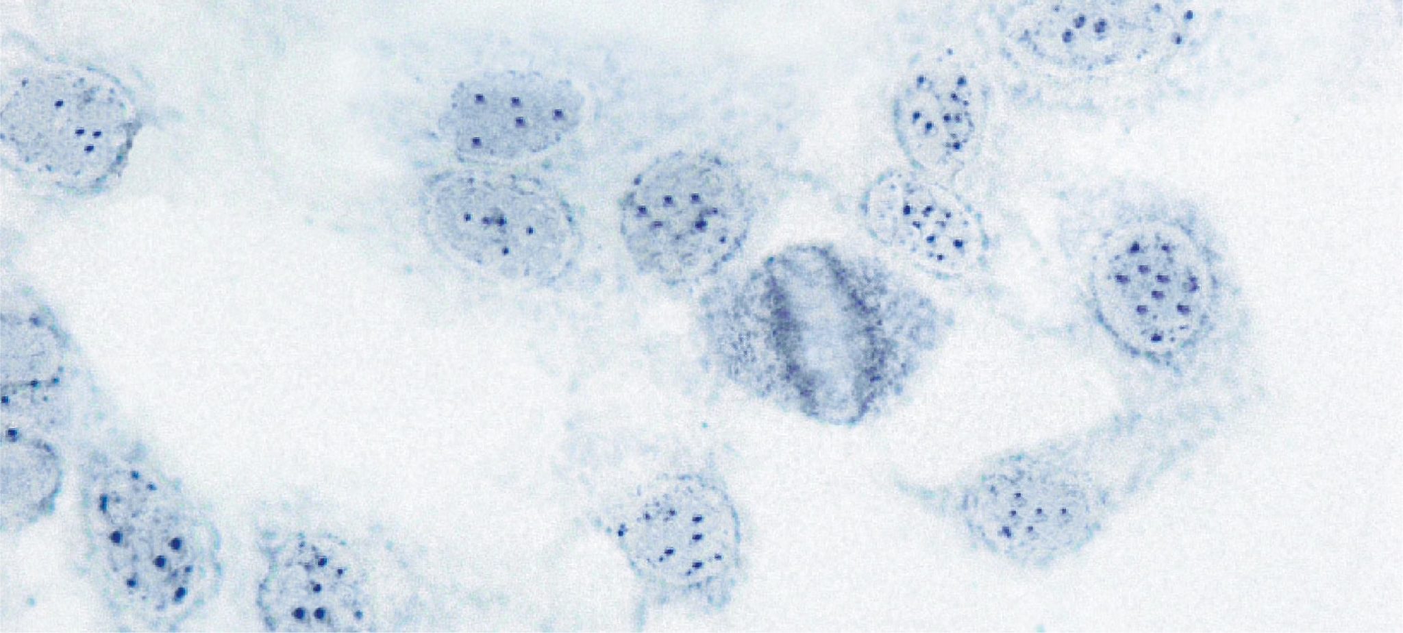 ANA HEp-2 Colorzyme® Test System – Immuno Concepts