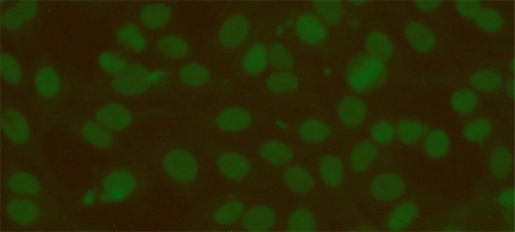 ANA HEp-2 Fluorescent Test System - Immuno Concepts