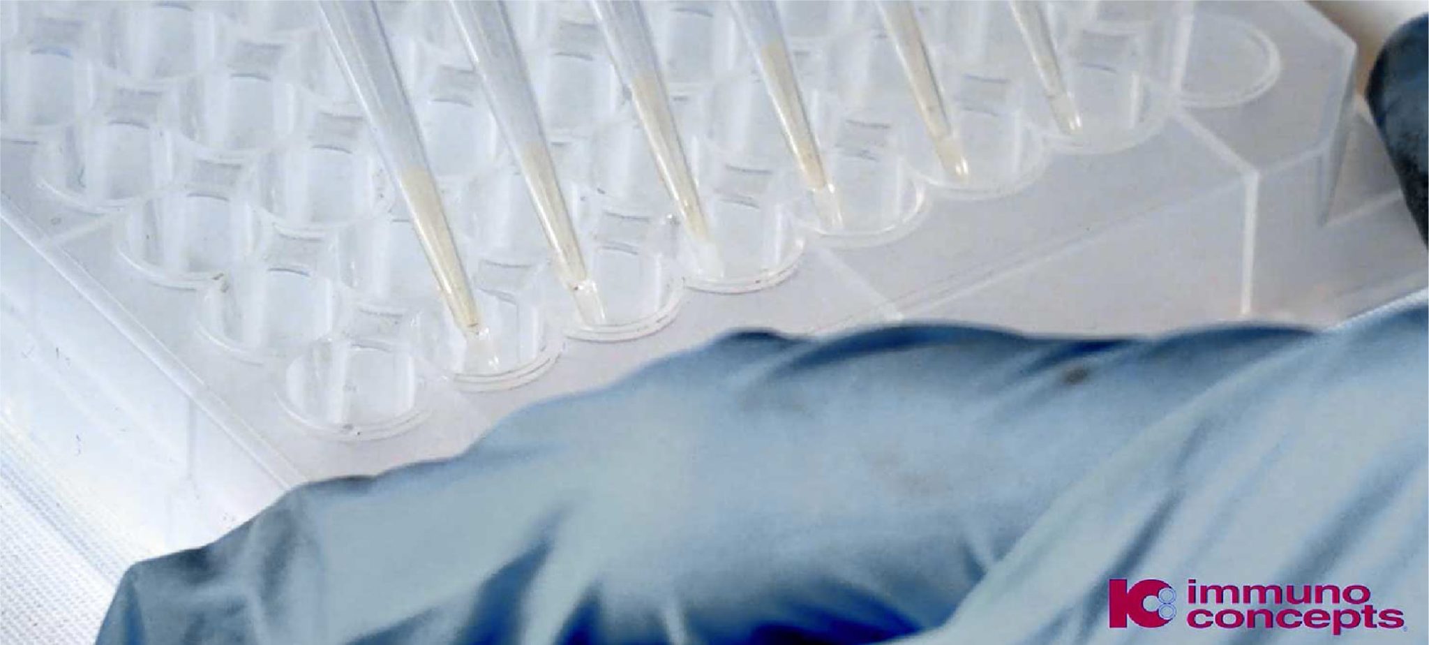 RELISA® MPO/ PR3 ANCA Test System – Immuno Concepts