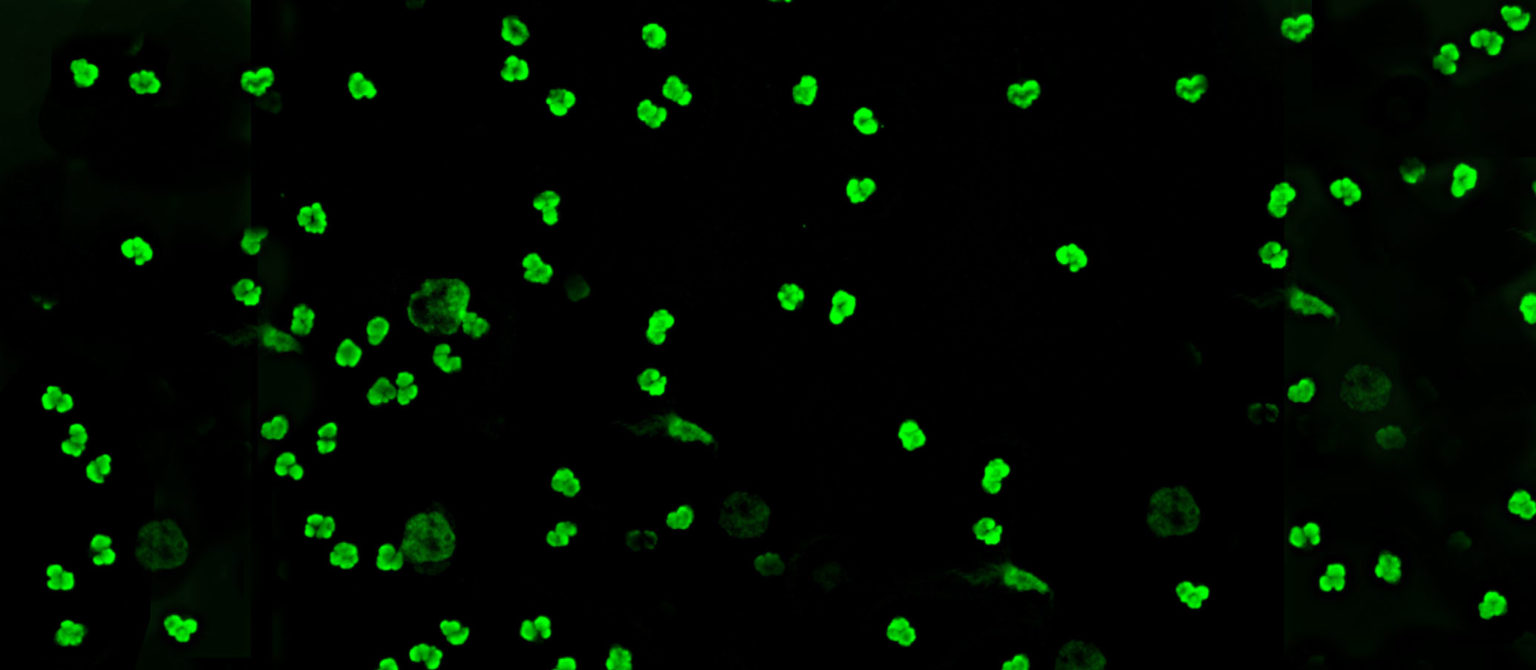 ANCA-L Ethanol Fluorescent Test System – Immuno Concepts