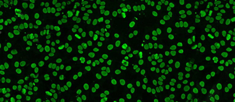 ANA HEp-2 Fluorescent Test System – Immuno Concepts